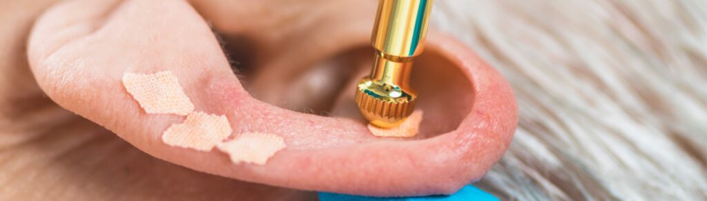 Servicio de auriculoterapia en Teraxis